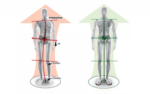 Foot Levelers Custom Made Orthotics in Atlanta - Le Reve Spinal Care